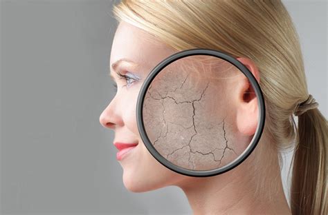 Macchie Sul Viso Rimedi Efficaci Prodotto Speciale Pulizia Viso Estetista