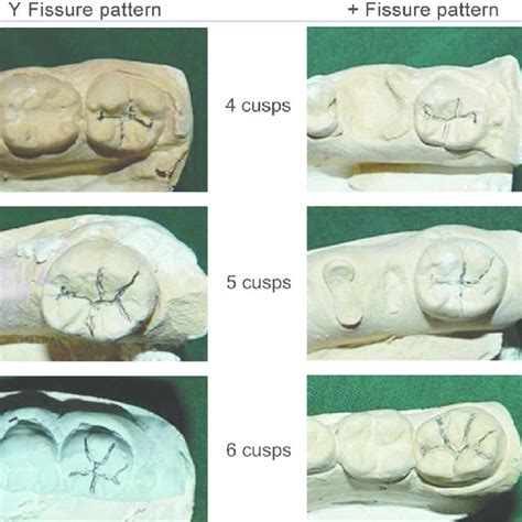 The Y 5 Lower Molar Pattern Is Found In Living