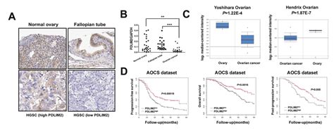 Repression Of Pdlim2 Is Associated With Ovarian Cancer Prognosis A