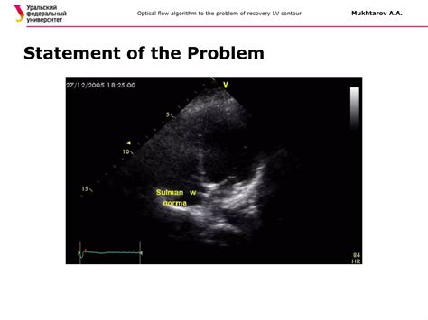 The Usage Of Optical Flow Algorithm To The Problem Of Recovery Contour