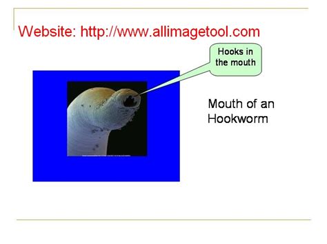 Dr Moins Blog Ancylostomiasis