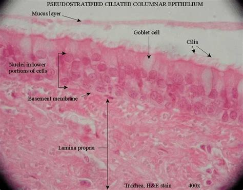 ciliated simple columnar epithelium labeled
