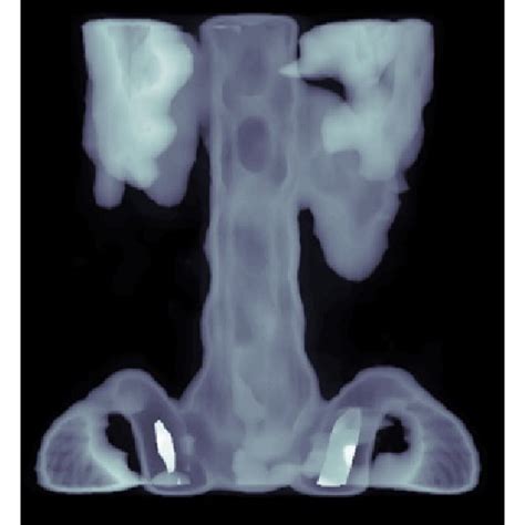 a trabecular bone image b segmentation using our proposed