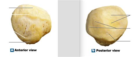 Patella Bone Diagram