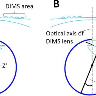 CSV E Contrast Sensitivity Chart Download Scientific Diagram