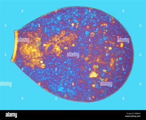Testate Amoeba Nepela Bohemica Prep By K Brocklehurst Jamin Lebedeff Ic