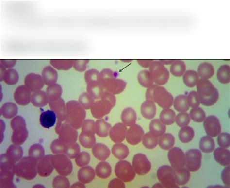 Basophil Slide Diagram Quizlet