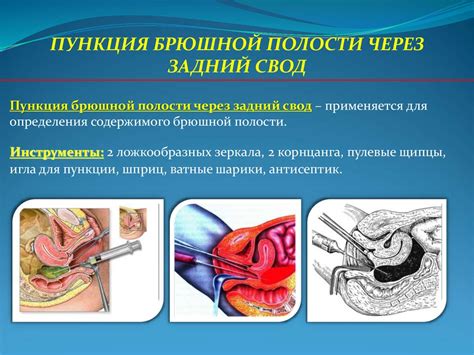 Методы исследования в гинекологии - презентация онлайн