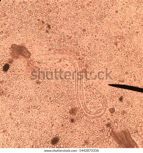 Rhabditiform Larva Strongyloides Stercoralis Showing Rhabditiform Stock