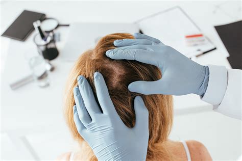 Hair Loss And Scalp Disorders Brisbane — Skin Partners Brisbane