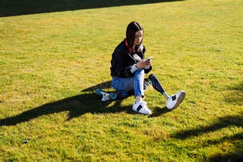 Young Woman Student With Prosthetic Leg Sitting On Green Grass In