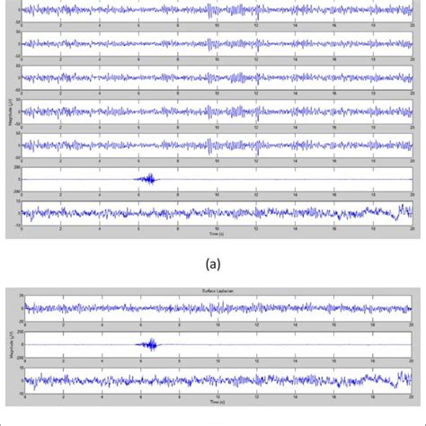 Preprocessing With Surface Laplacian Filtering A Raw Eeg Signals B