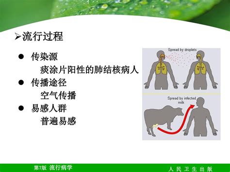 第二十七章 结核病 Tuberculosis Ppt Download