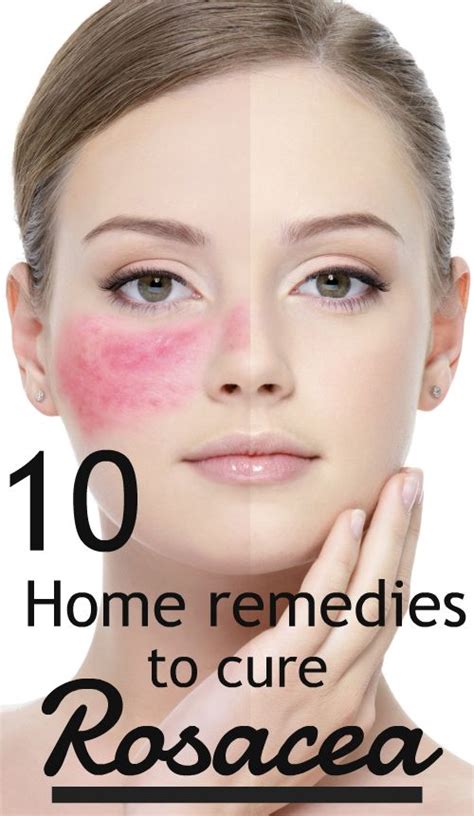 Published On Skinstop Itching Natural Remedies