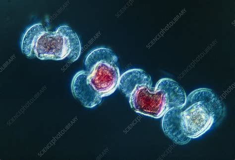 Lm Of Pollen Grains Of Pinus Sylvestris Stock Image B7860382