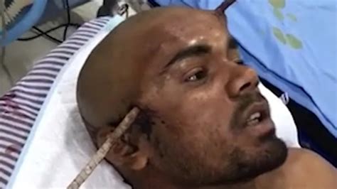 El Espeluznante Accidente Que Sufrió Un Joven En India Cayó En Un Pozo