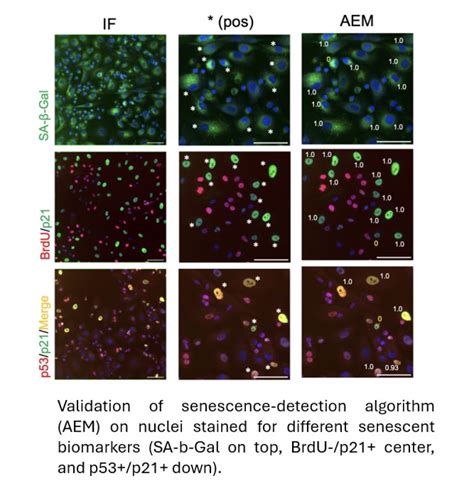 Ai Breakthrough In Identifying Senescent Cells Signals Progress In Aging And Cancer Therapy