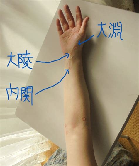 化学物質過敏症 391）手根管症候群に効くツボ 神戸エサレン Healing Space La Ola 靑い草原