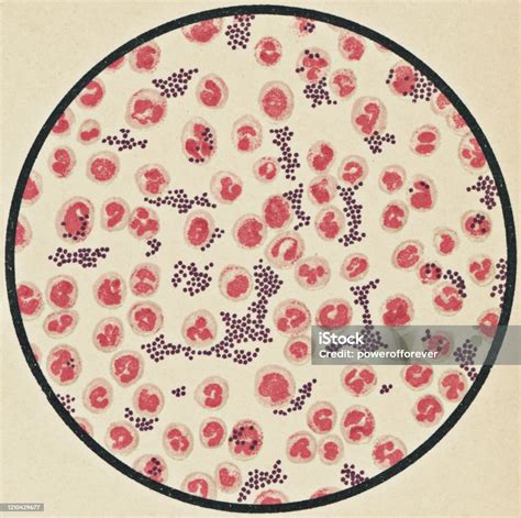 Vetores De Visão Microscópica Da Bactéria Staphylococcus Aureus De Um