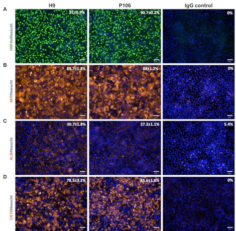 Hepatic Progenitor Characterization At Day 10 Hepatic Progenitors