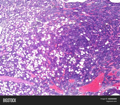 Low Magnification Image And Photo Free Trial Bigstock