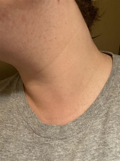 Sooo Frustrating One Day Of Not Shaving I Shave And Hide With Makeup Every Day Im So Self