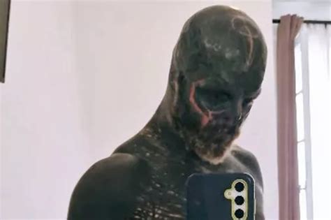Body Modification Fan On Mission To Turn Into Black Alien Makes Wild