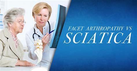 Facet Arthropathy Vs Sciatica