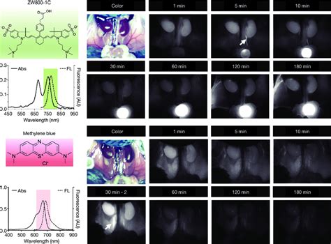 Ureter Visualization After Intravenously Injecting Zw800 1 Or Methylene
