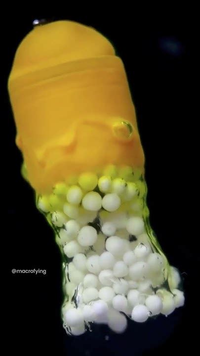 අපි බොන බෙහෙත් පෙති බඩ අැතුලේ දිය වෙන්නේ මේ විදියට තමා Youtube