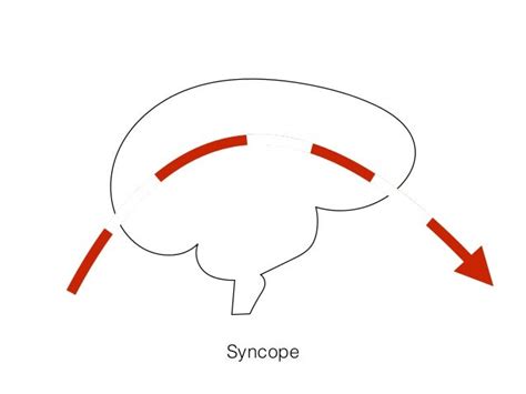 Syncope Etiology And Pathophysiology