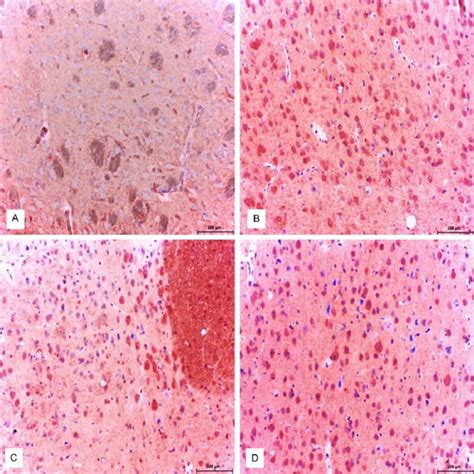 Neuronal Necrosis Areas Were Observed Hande Bar 100 μm A Neuronal
