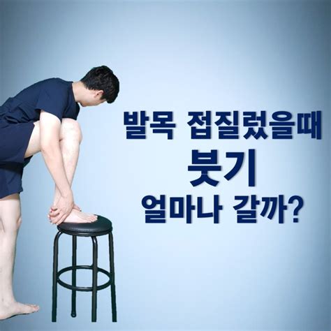 발목 접질렀을때 붓기 얼마나 갈까 Ft 찜질방법 네이버 블로그