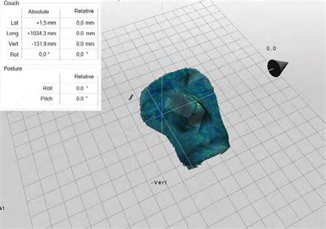 The Live Surface And The Reference Surface In Perfect Alignment
