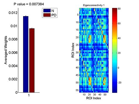 Alterations In Dynamic Brain Connectivity Patterns In Parkinsons