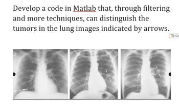 Answered Develop A Code In Matlab That Through Filtering And More
