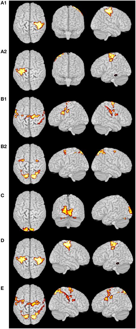 Clustering Results From Real Fmri Data The Clusters A1a2d Were