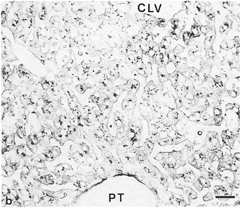 Localization Of Afp Mrnas And Protein In 1 D Old Rat Liver Sections