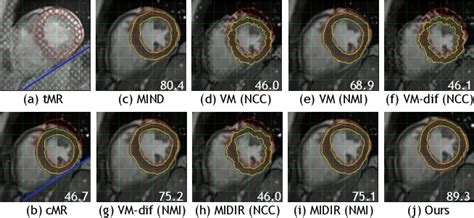 Figure From Unsupervised Exemplar Based Image To Image Translation And Cascaded Vision