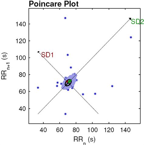 Poincare Plot For Normal Rhythm 111 Mat Download Scientific Diagram