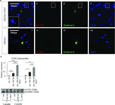 Neutrophils In The Brain Representative Sagittal Cortex Sections From