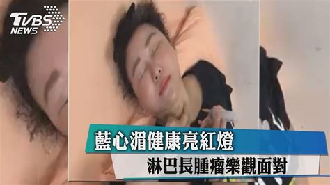 藍心湄健康亮紅燈 淋巴長腫瘤樂觀面對 Youtube