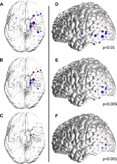 Table 1 From Automatic Detection Of Prominent Interictal Spikes In