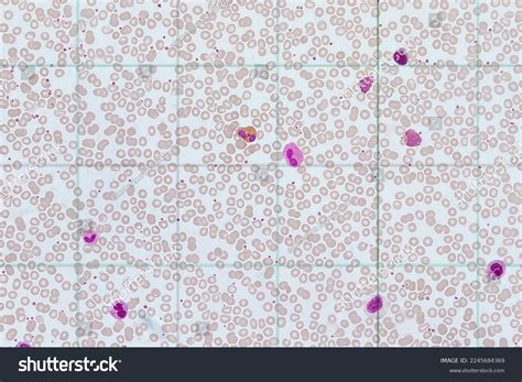 Smear Blood Under Microscope Leukocytes Located Stock Illustration