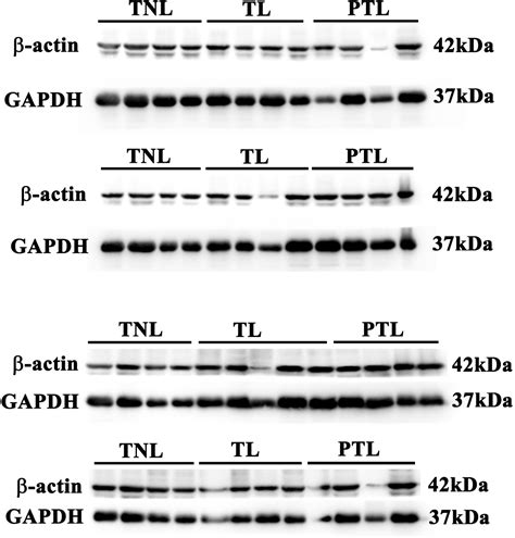 Expression Of 15 Hydroxyprostaglandin Dehydrogenase In Human Chorion Is