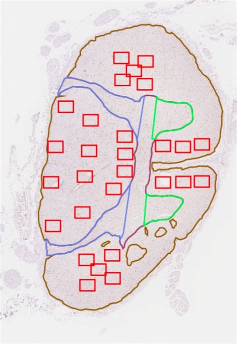 Batch Resize Annotations Qupath Image Analysis Imagesc Forum