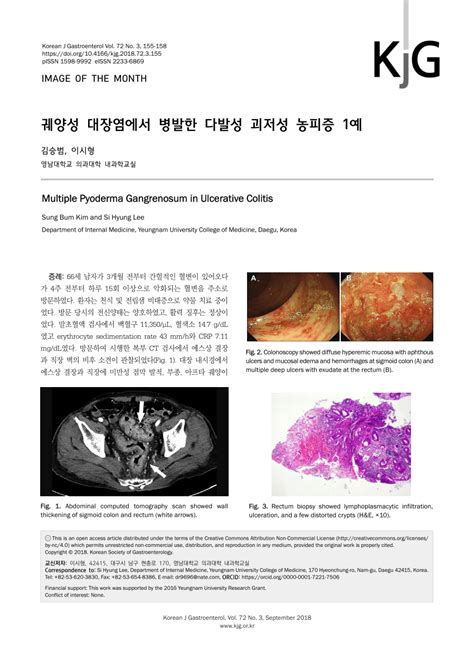 Pdf Multiple Pyoderma Gangrenosum In Ulcerative Colitis