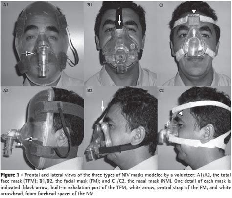 SciELO Brasil Influence Of Total Face Facial And Nasal Masks On