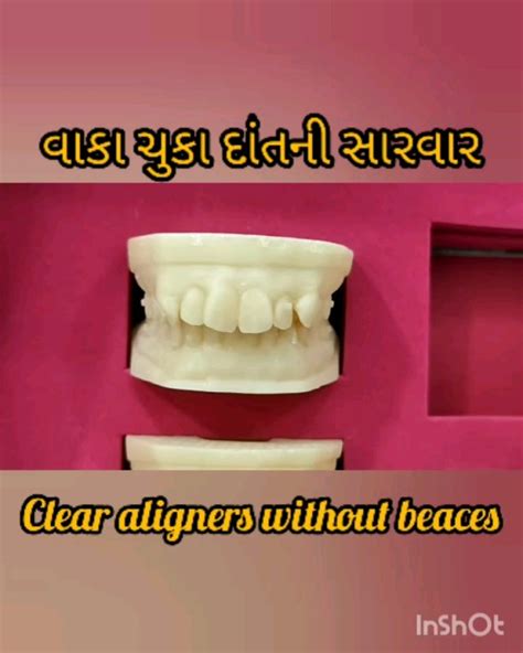 Dr Divyesh Patel Posted On Linkedin