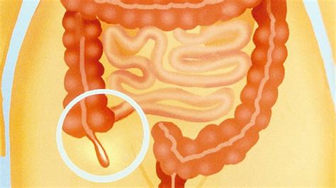 What Is The Appendix And What Does It Do Everyday Health